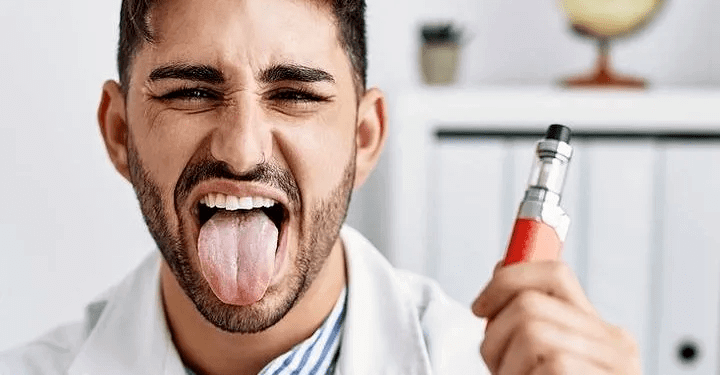 What is vapers tongue?