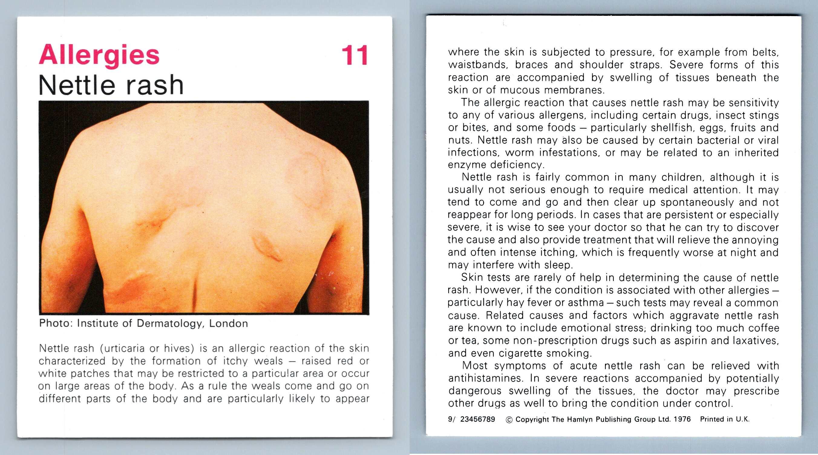 Nettle Rash #11 Allergies - Home Medical Guide 1975-8 Hamlyn Card