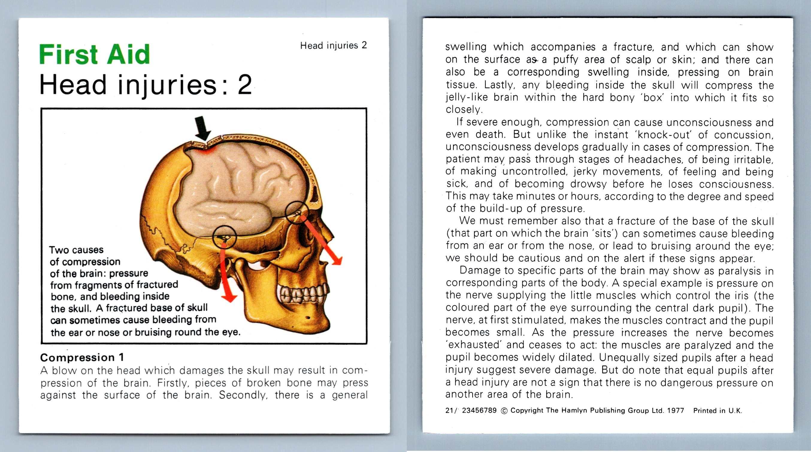 Head Injuries 2 First Aid Home Medical Guide 1975 8 Hamlyn Card