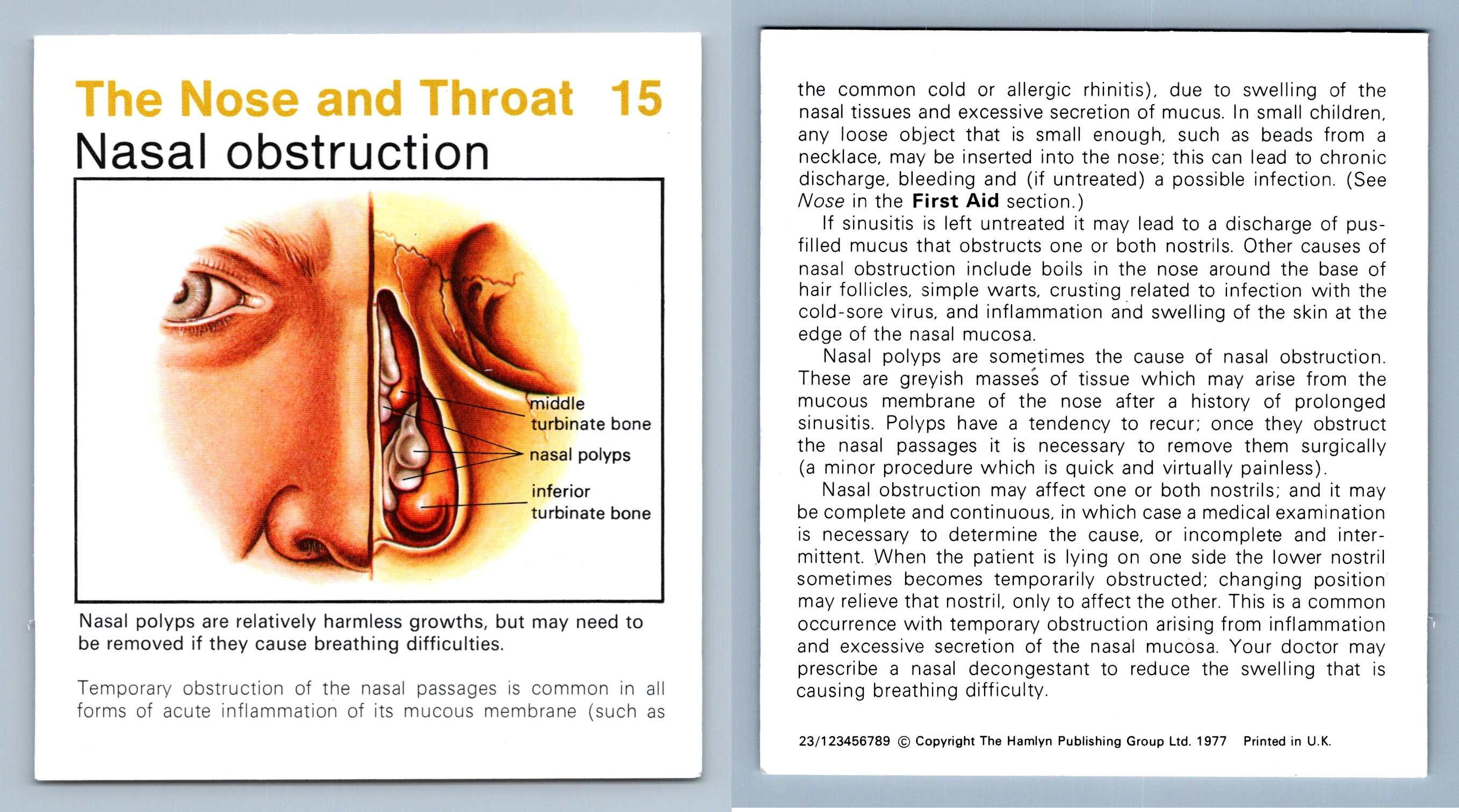 Nasal Obstruction #15 Nose & Throat Home Medical Guide 1975-8 Hamlyn Card