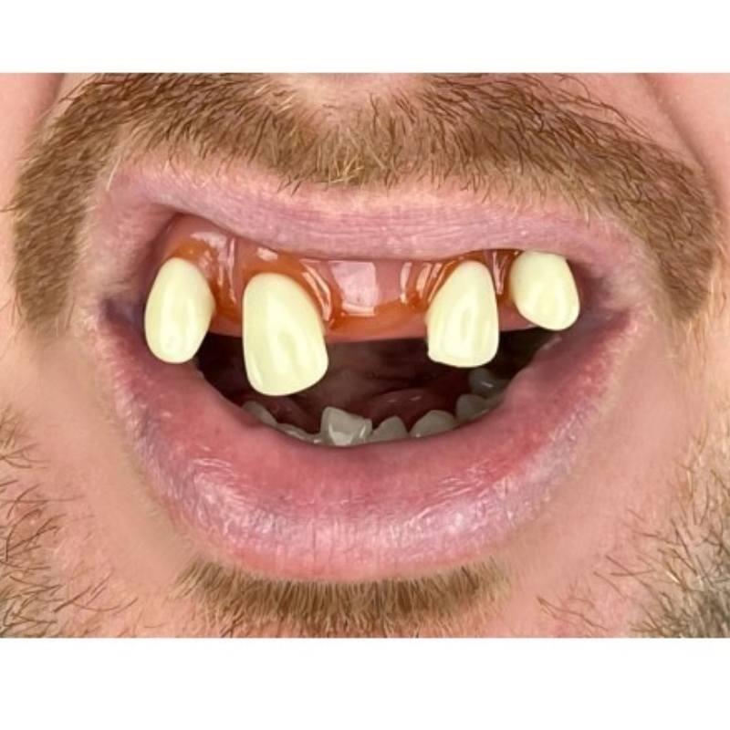 Tiger Teeth Customisable Denture by Billy Bob 10106 | Karnival Costumes