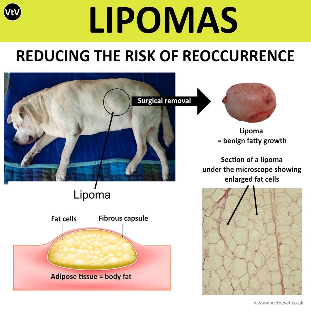 LIPOMAS - MEASURES THAT CAN HELP